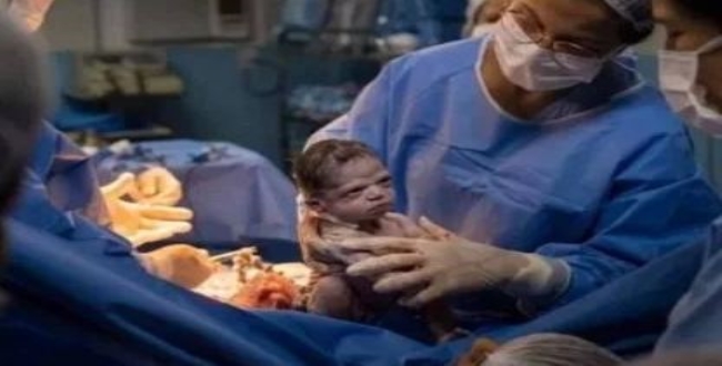 'நம்மள விட பயங்கர கோபக்காரனா இருப்பானோ'?! பிறந்தவுடன் அழாமல் ...